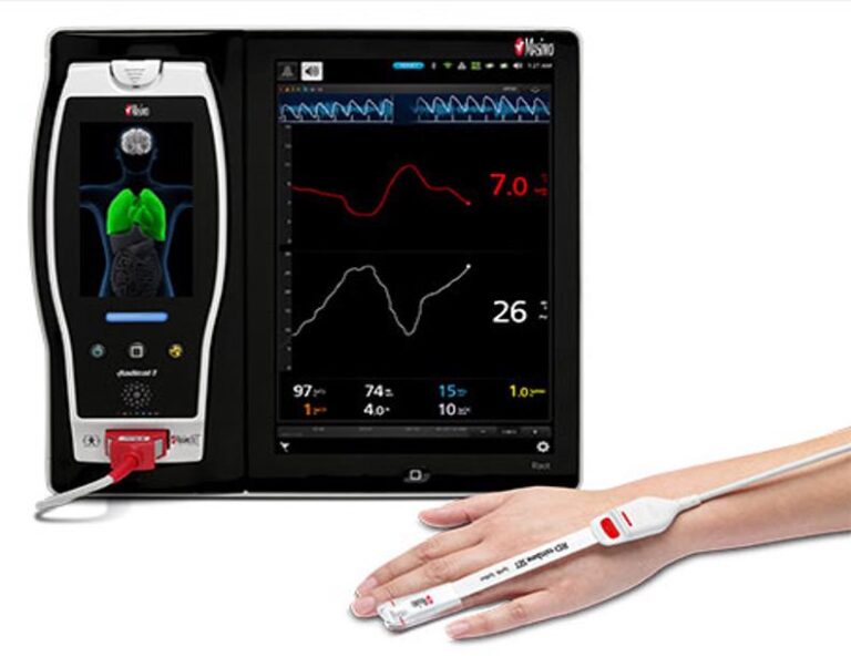 Masimo SpHb, noninvasive and continuous hemoglobin monitoring reduces ...